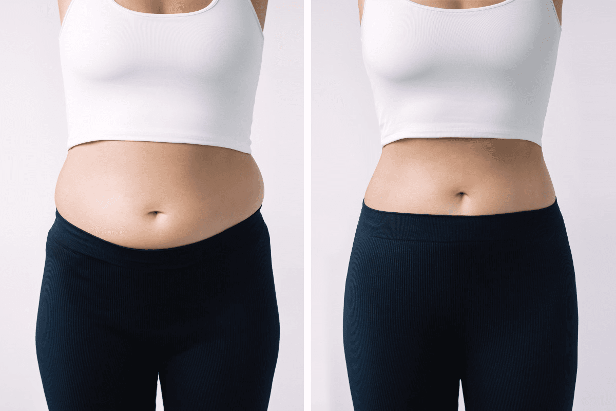 Cost of Body Contouring: Prices, Insurance, and Financing Guide